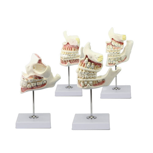 Development of Dentition Models Set, 4 Stages [SKU: MG36200] – Nasco ...