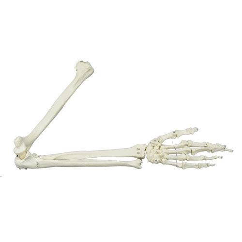 Arm Model, Wire Mounted [SKU: MG22957] – Nasco Healthcare