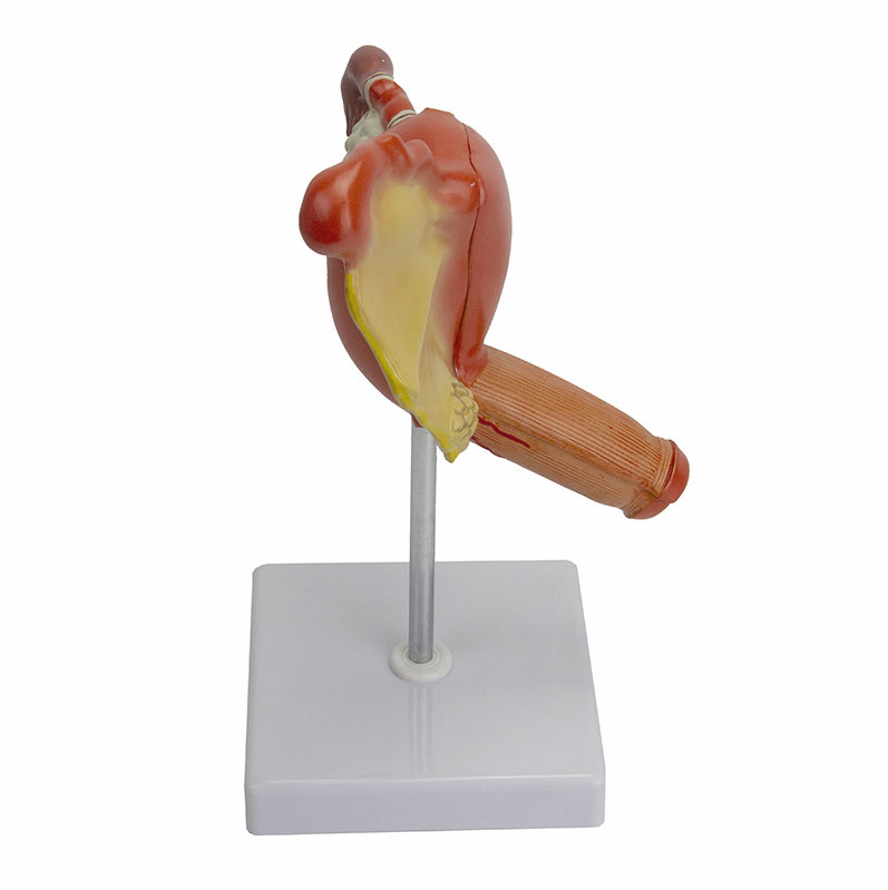 Female Genital Organ with Pathology Model, 2 Parts [SKU: MG29947 ...
