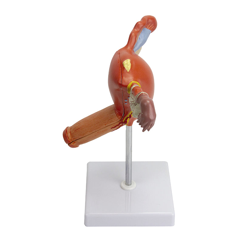 Female Genital Organ with Pathology Model, 2 Parts [SKU: MG29947 ...