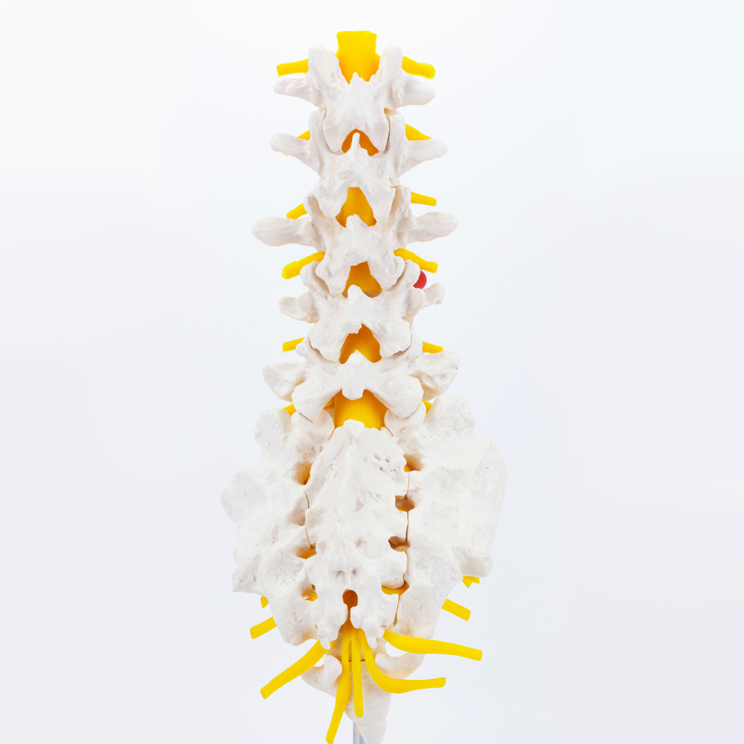 Lumbar Spine Model [SKU: MG21887] – Nasco Healthcare