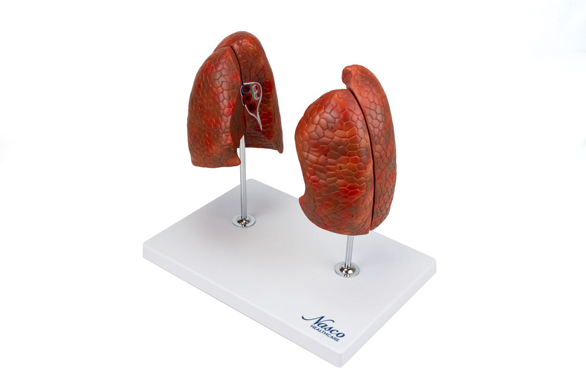 Modelo de Pulmón, 4 Partes – Nasco Healthcare