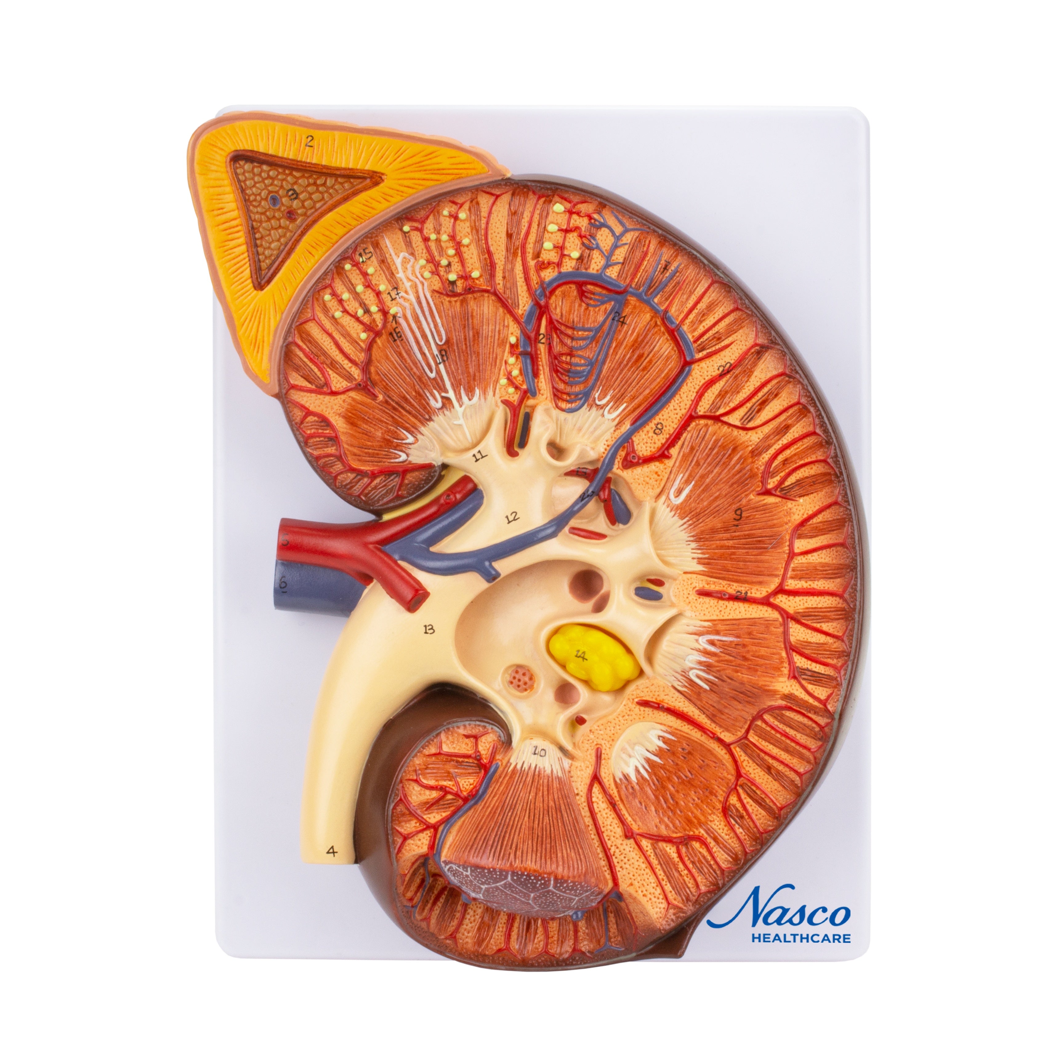 Kidney Section with Adrenal Gland Model, 3X Enlarged – Nasco Healthcare