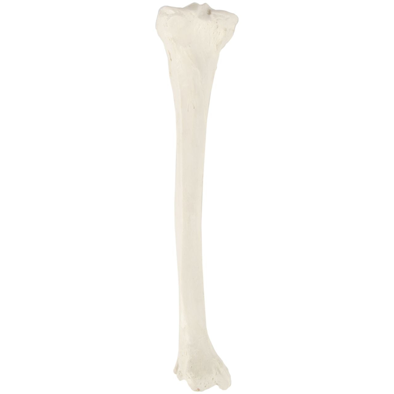 Tibia Model [SKU: MG31959] – Nasco Healthcare