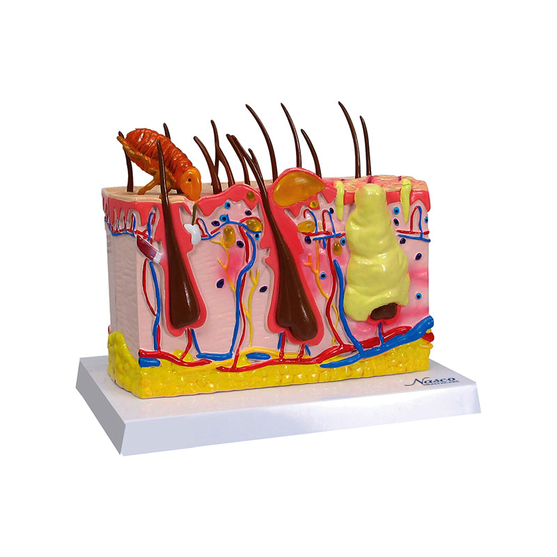 Normal & Pathological Canine Skin Section Model, Enlarged – Nasco ...
