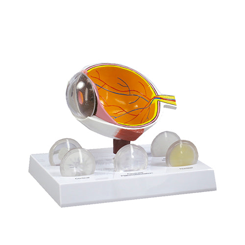 Eye with Cataract Model [SKU: MG38396] – Nasco Healthcare