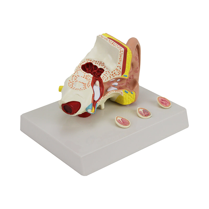 Ear with Pathology Model, 1.5X Enlarged [SKU: MG29985] – Nasco Healthcare
