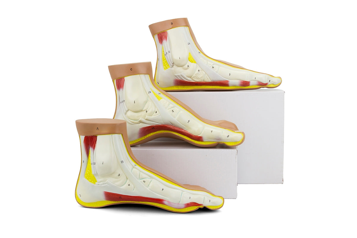 Normal and Abnormal Foot Models, Set of 3 [SKU: MG22042] – Nasco Healthcare