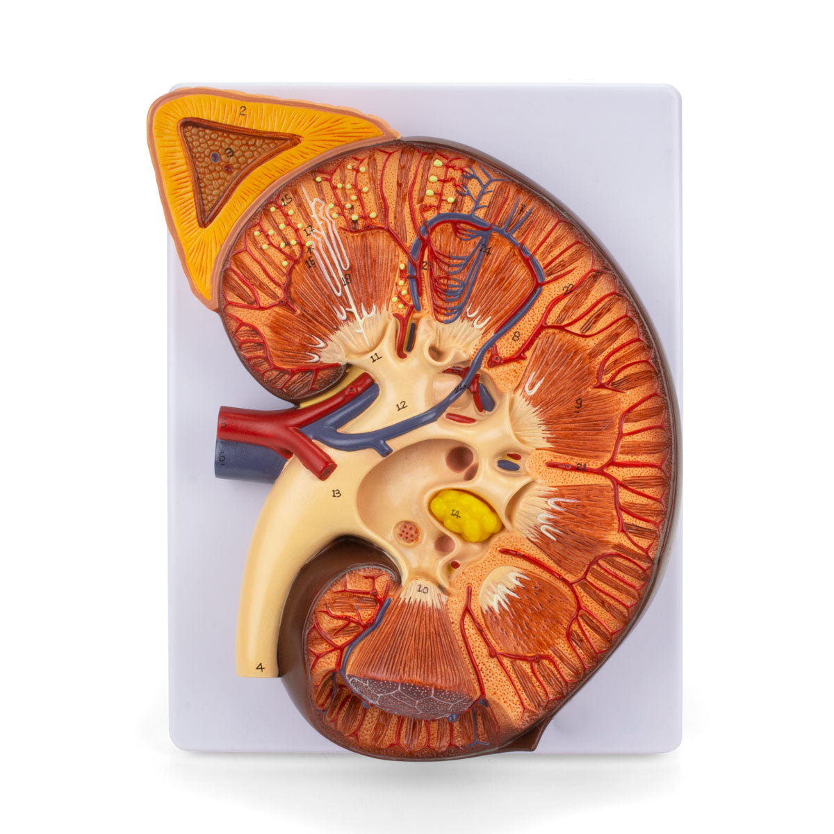 Kidney Section with Adrenal Gland Model, 3X Enlarged [SKU: MG31103 ...