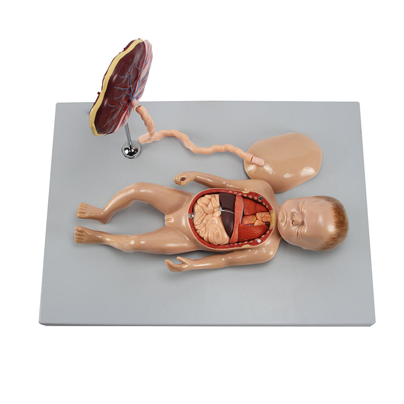 Fetus Model with Placenta and Internal Organs Model [SKU: MG13920 ...