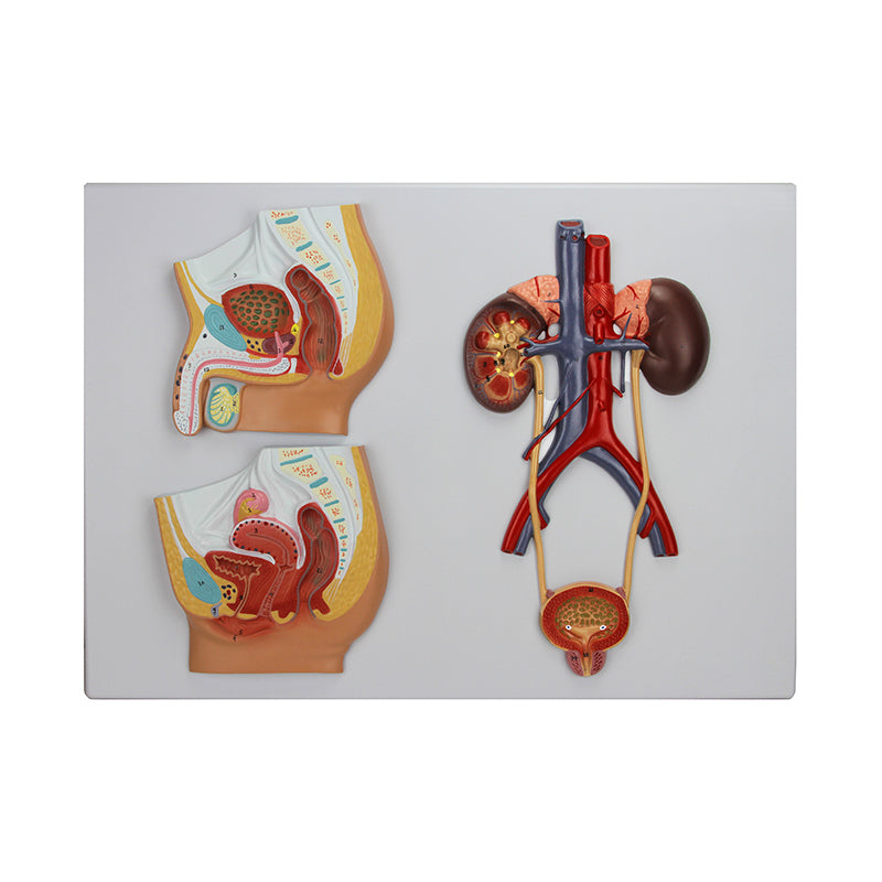 Male & Female Urinary Tract Cross Section Model [SKU: MG31111] – Nasco ...
