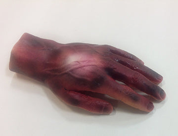 Burn Hand 2Nd & 3Rd Degree – Nasco Healthcare
