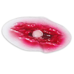 Bladder Wound – Nasco Healthcare