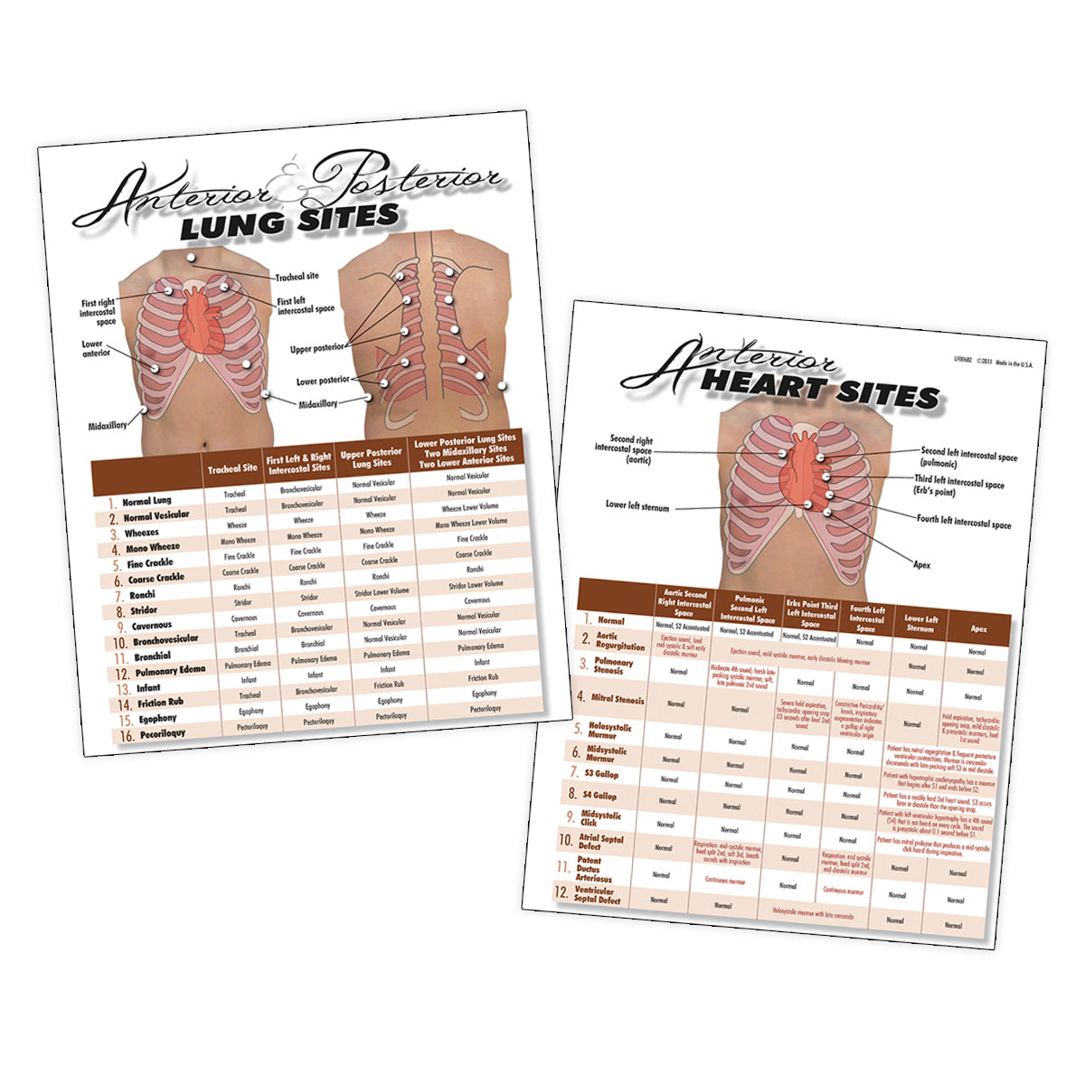 Neonatal Lung Sounds Diagram How To Perform Chest Auscultation And